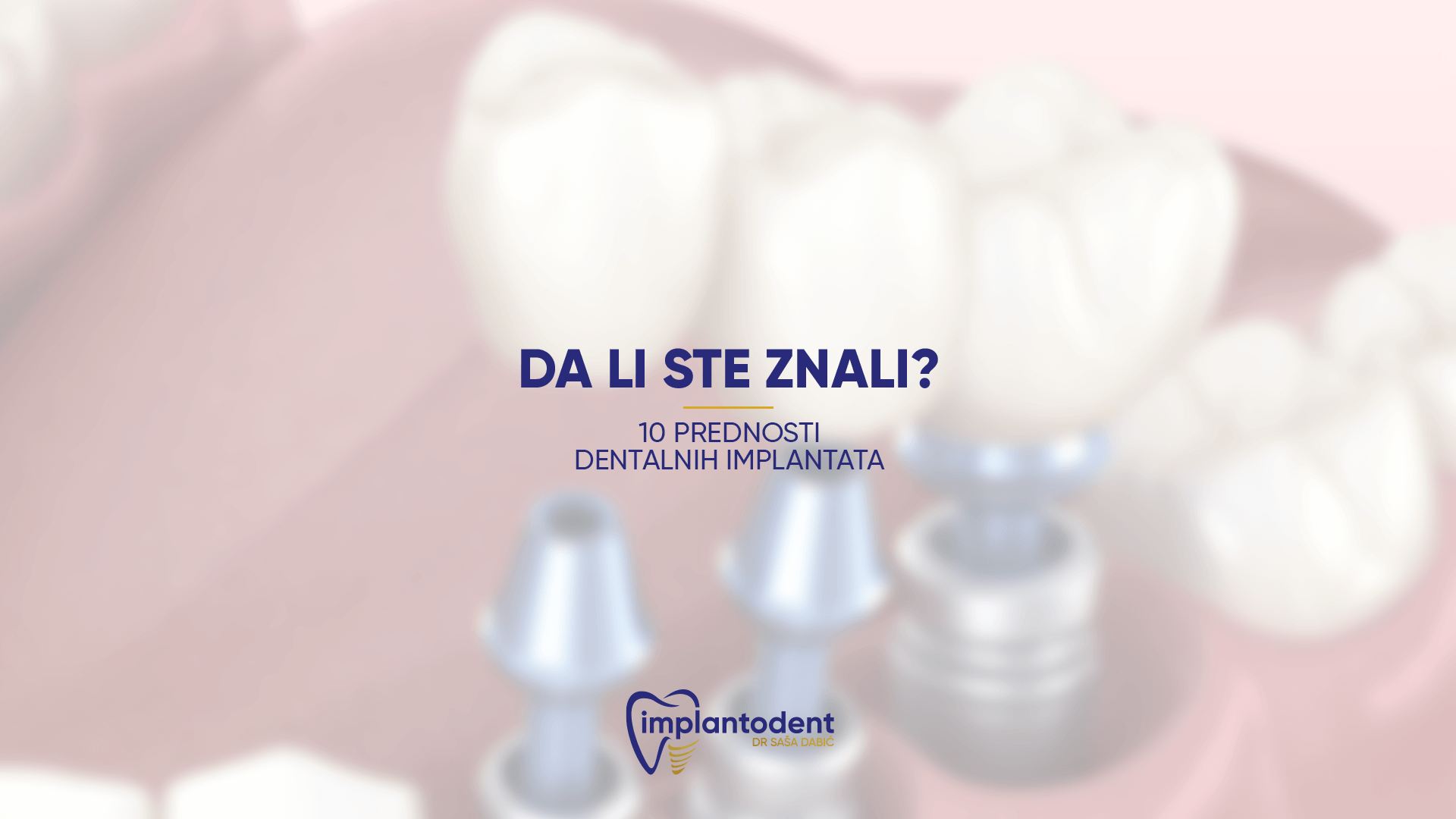 10 prednosti dentalnih implantata - IMPLANTODENT Dr Saša Dabić